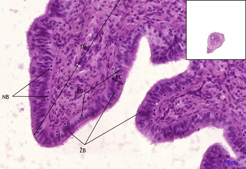 Tuba uterina (isthmus) - HE – WikiSkripta