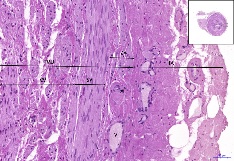 Ureter - HE – WikiSkripta