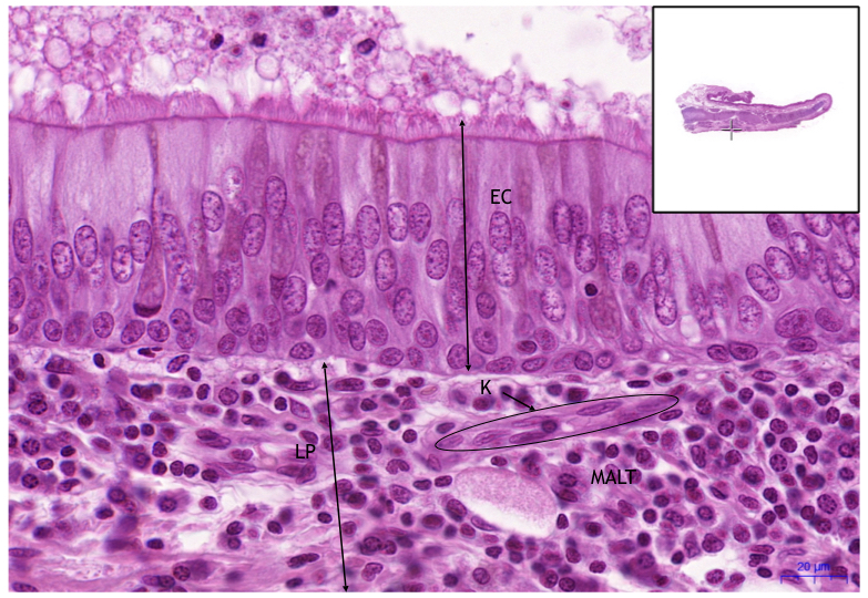 Epiglottis - HE – WikiSkripta