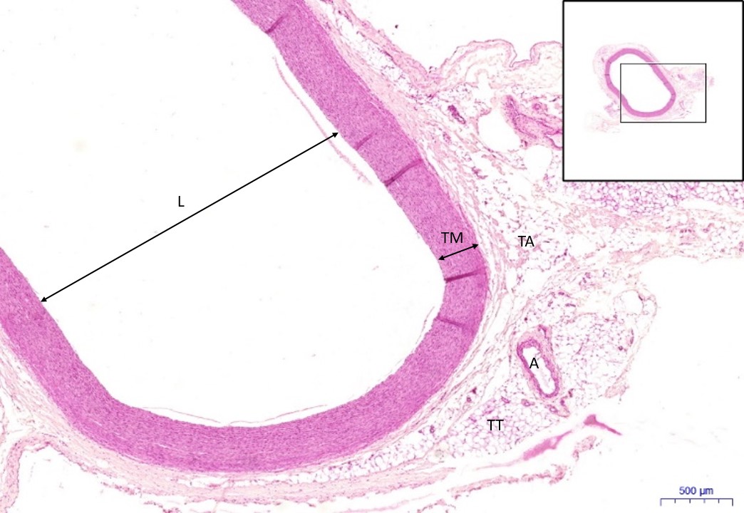 Elastická arterie / Elastic artery (aorta) - HE – WikiSkripta