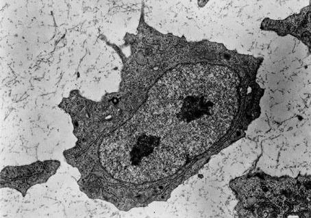 Mesenchym (preparát) – WikiSkripta