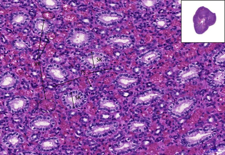 Ledvina / Kidney - HE – WikiSkripta