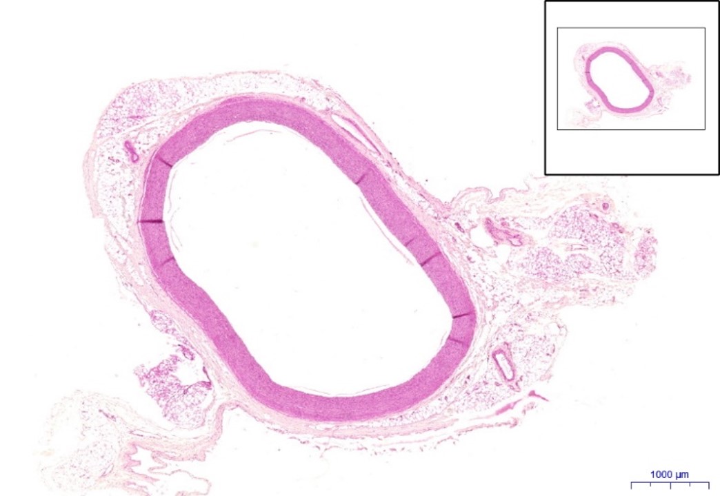 Elastická arterie / Elastic artery (aorta) - HE – WikiSkripta