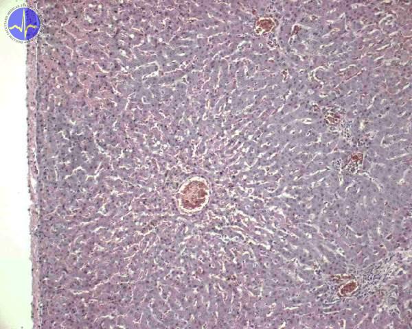 Játra (SFLT) – WikiSkripta