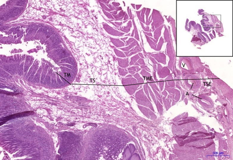 Kardie žaludku / Stomach cardia - HE – WikiSkripta
