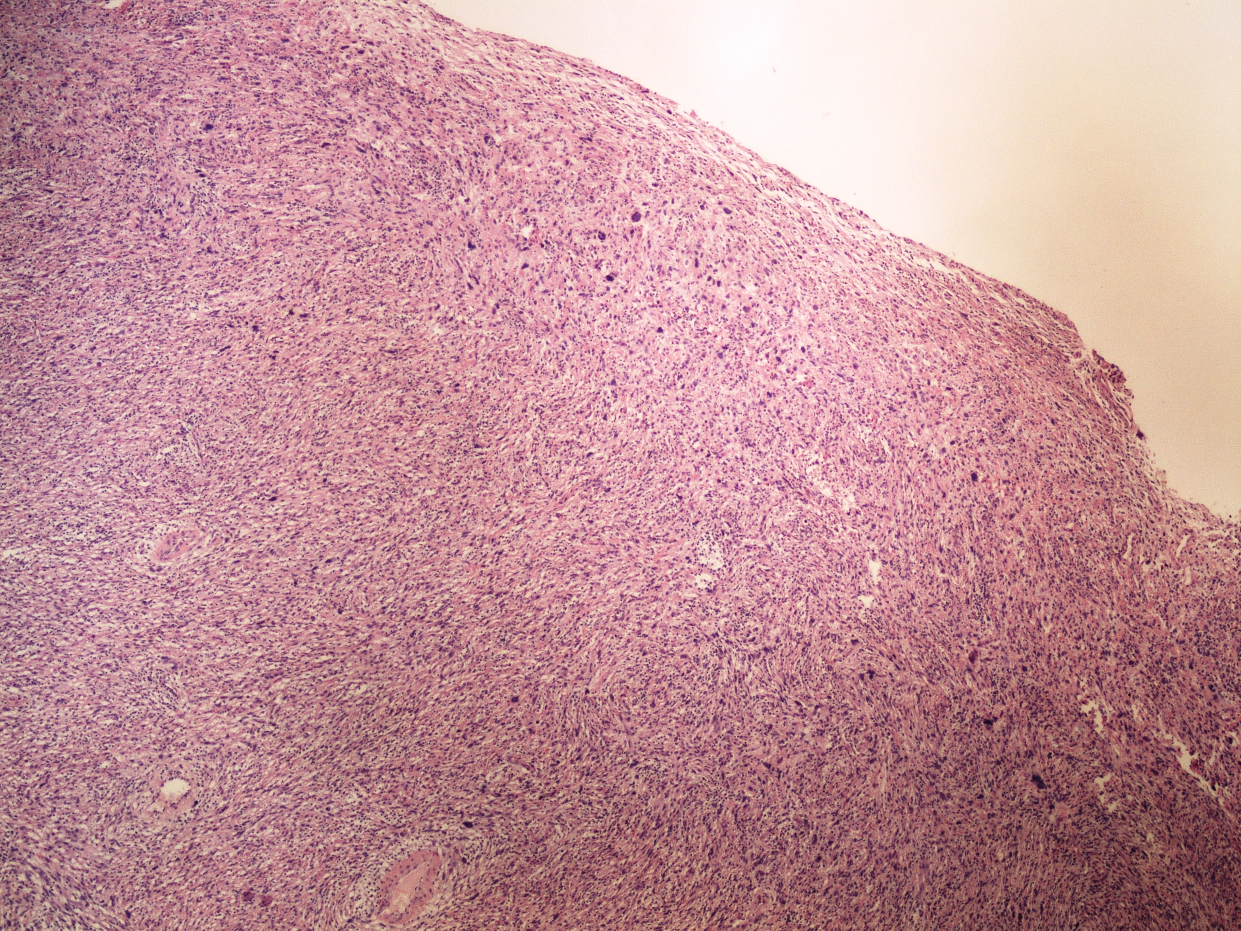 Modul OZPP - Praktikum č. 10 (zoom) – WikiSkripta