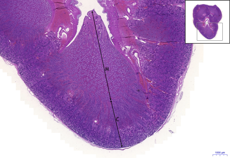 Ledvina / Kidney - HE – WikiSkripta