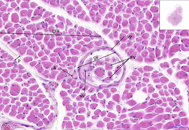 Svalové vřeténko / Muscle spindle - HE – WikiSkripta