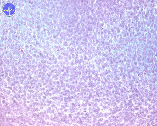 Mesenchym (preparát) – WikiSkripta