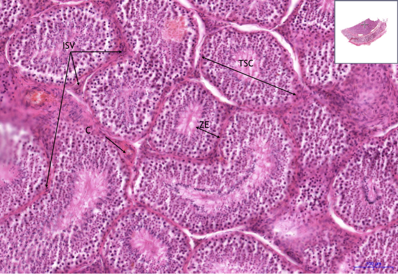 Testis - HE – WikiSkripta