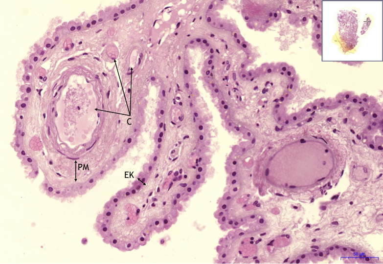Plexus choroideus - HE – WikiSkripta