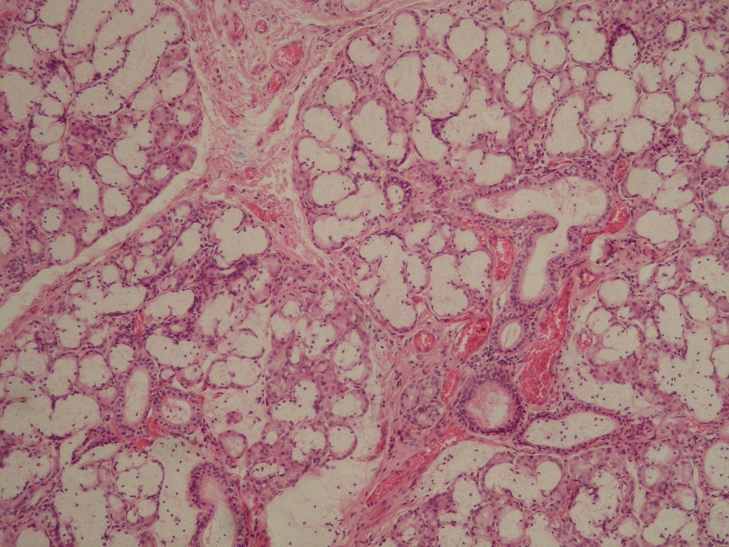 Gl. submandibularis (SFLT) – WikiSkripta