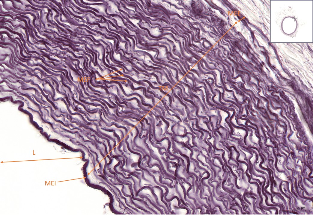 Elastická arterie / Elastic artery (aorta) - WRF – WikiSkripta