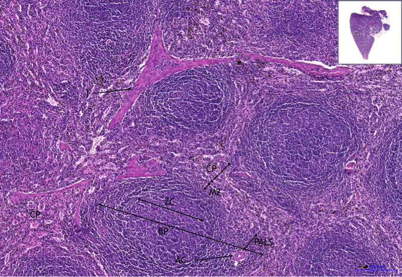 Slezina / Spleen - HE – WikiSkripta