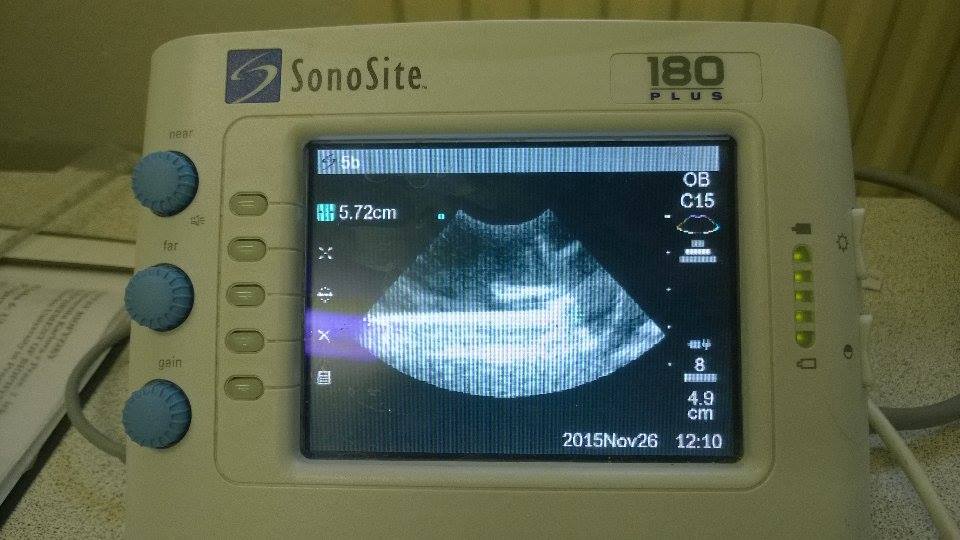 Ultrasonografie (2. LF UK) – WikiSkripta