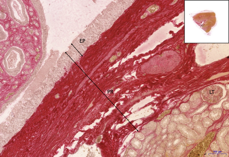 Ledvina / Kidney - WvG – WikiSkripta