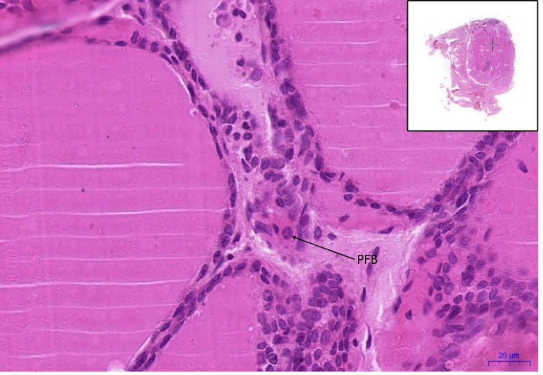 Štítná žláza / Thyroid gland - HE – WikiSkripta