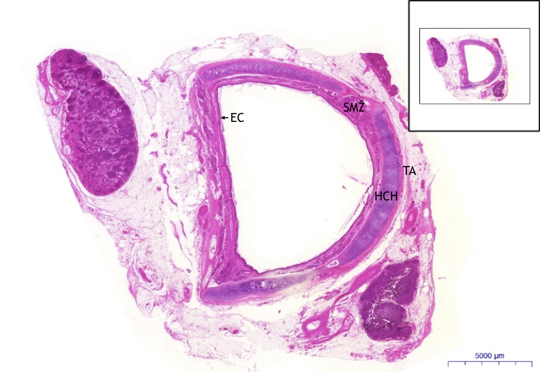 Trachea - HE – WikiSkripta