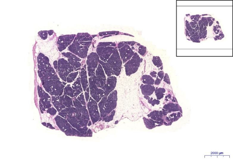 Pancreas - HE – WikiSkripta