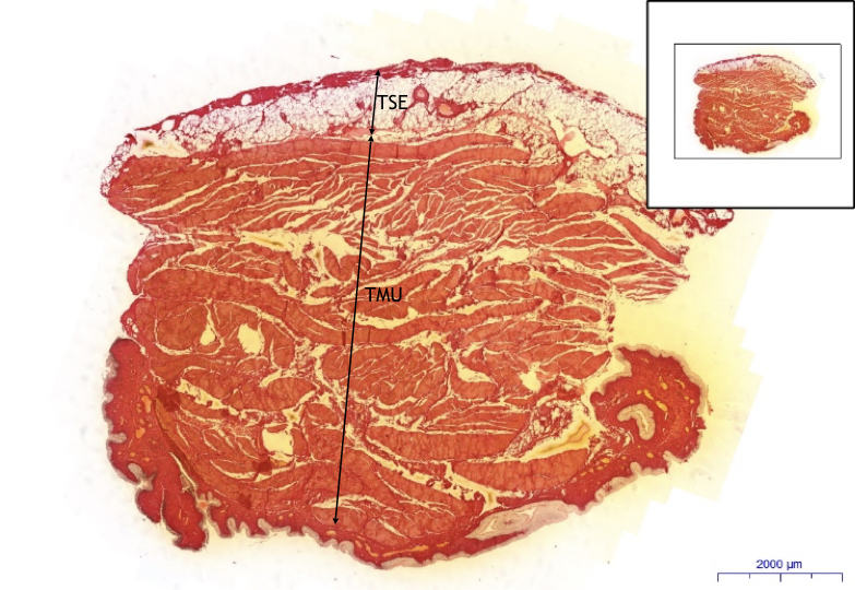 Močový měchýř / Urinary bladder - WvG – WikiSkripta