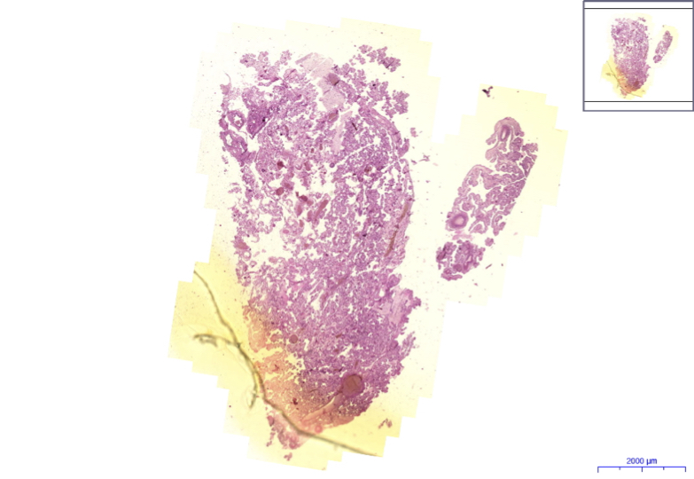 Plexus choroideus - HE – WikiSkripta