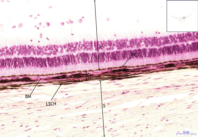 Bulbus oculi - HE – WikiSkripta