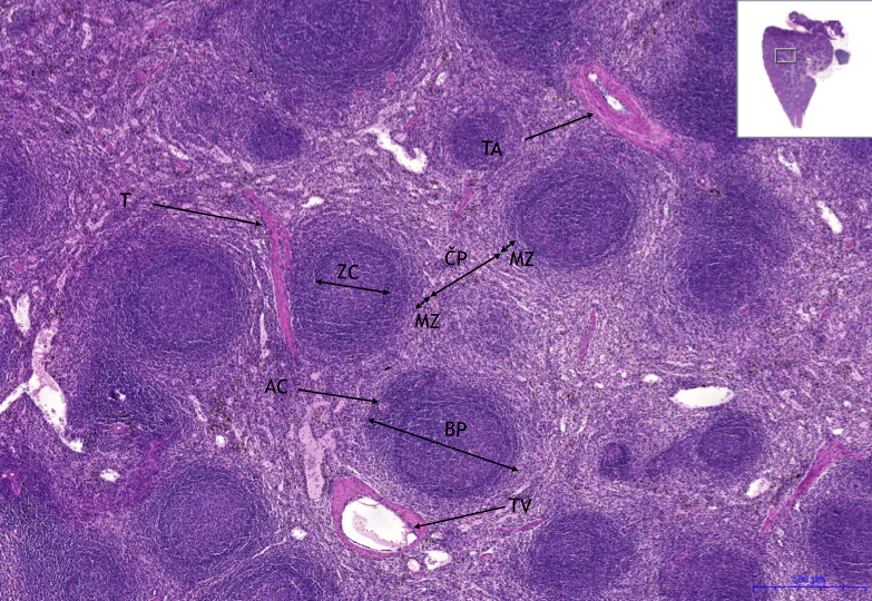 Slezina / Spleen - HE – WikiSkripta