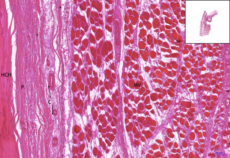 Larynx - HE – WikiSkripta