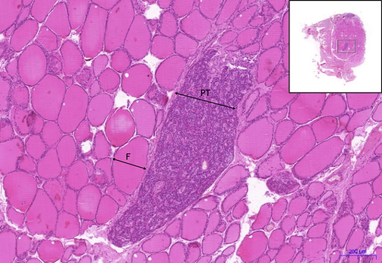 Štítná žláza / Thyroid gland - HE – WikiSkripta