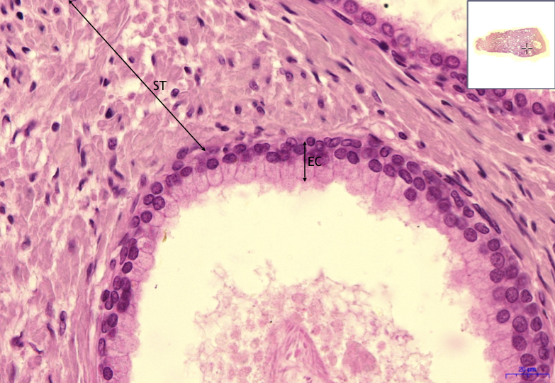Prostata - HE – WikiSkripta