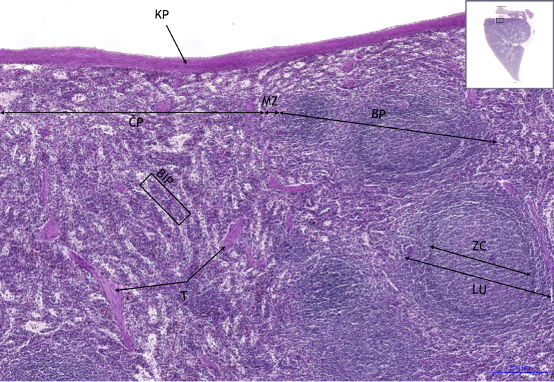 Slezina / Spleen - PAS – WikiSkripta