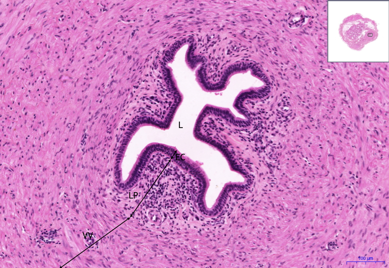 Funiculus spermaticus - HE – WikiSkripta