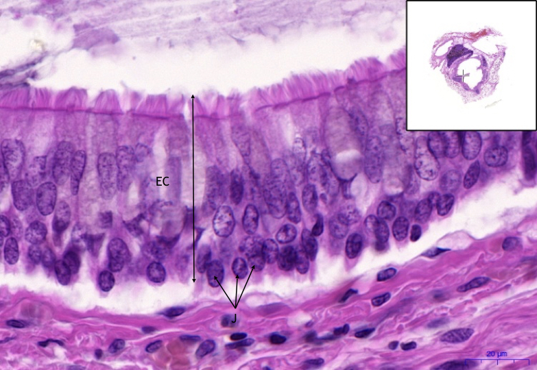Bronchus – HE – WikiSkripta