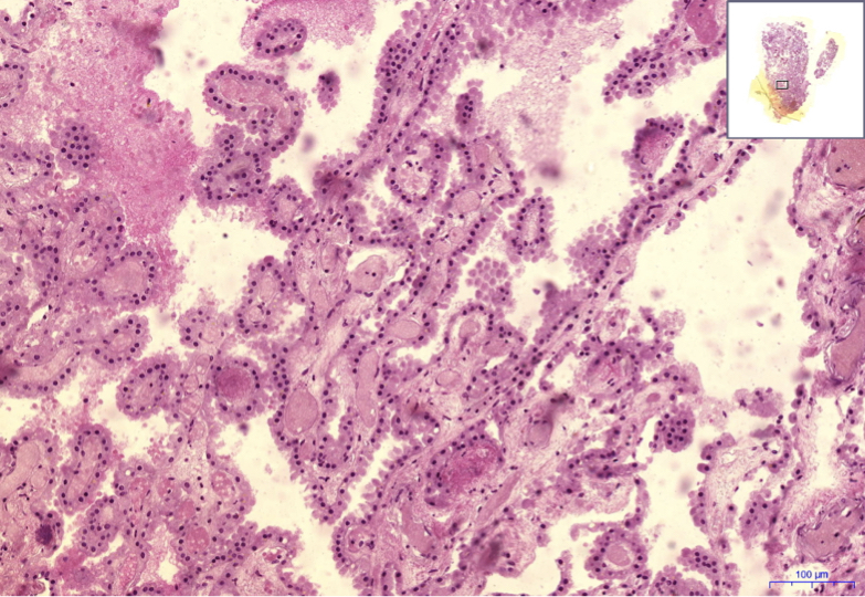 Plexus choroideus - HE – WikiSkripta