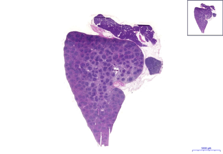 Slezina / Spleen - HE – WikiSkripta