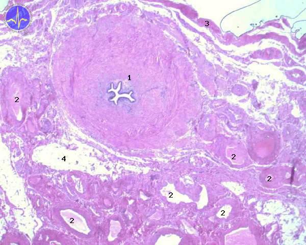 Funiculus spermaticus (SFLT) – WikiSkripta