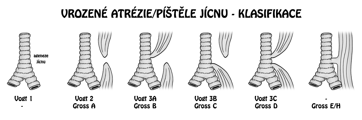 Vrozené vady gastrointestinálního traktu – WikiSkripta