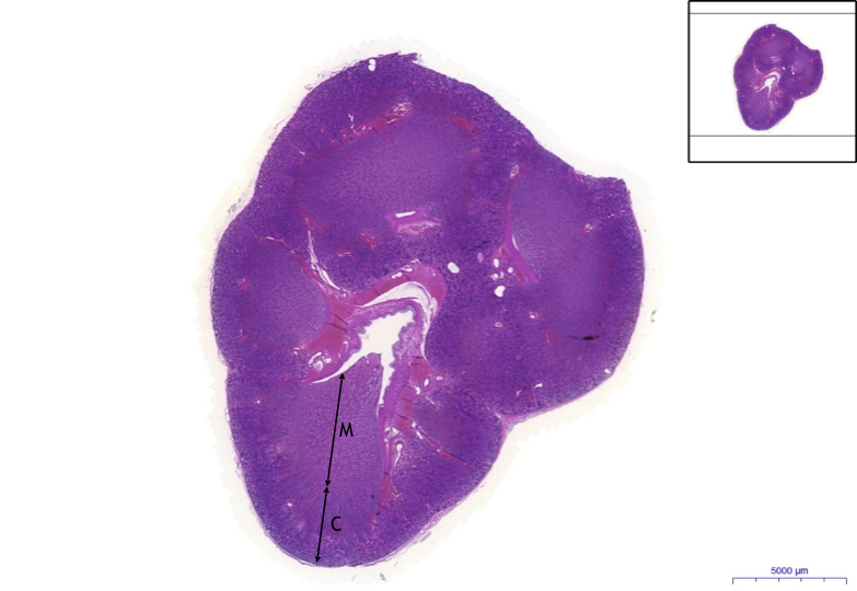 Ledvina / Kidney - HE – WikiSkripta