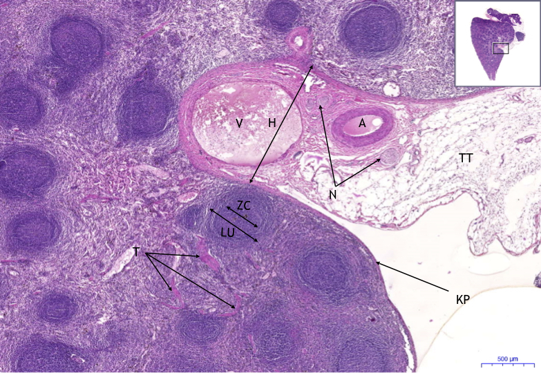 Slezina / Spleen - HE – WikiSkripta