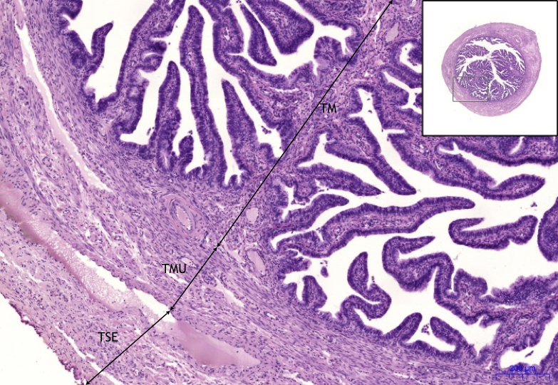 Tuba uterina (ampulla) - HE – WikiSkripta
