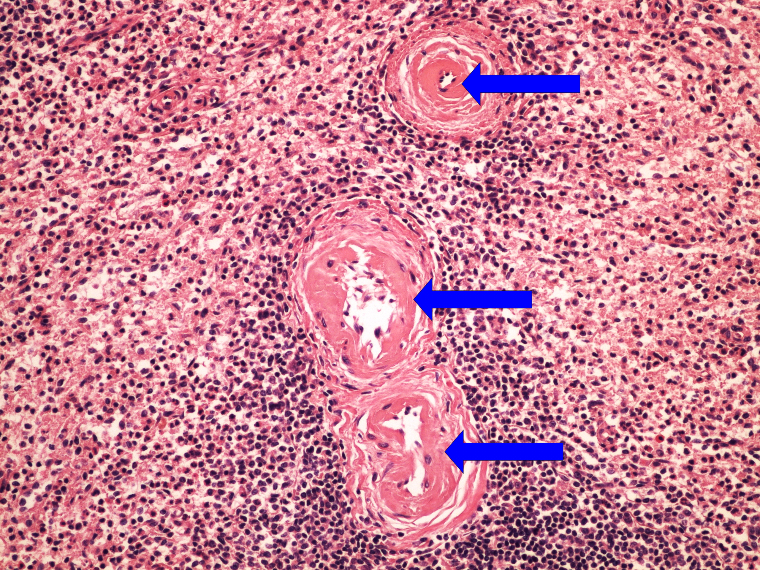 Modul OZPP - Praktikum č. 3 (zoom) – WikiSkripta