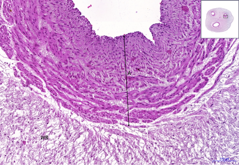 Pupečník / Umbilical cord - HE – WikiSkripta
