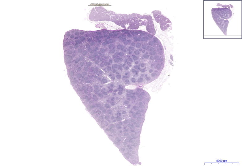 Slezina / Spleen - PAS – WikiSkripta