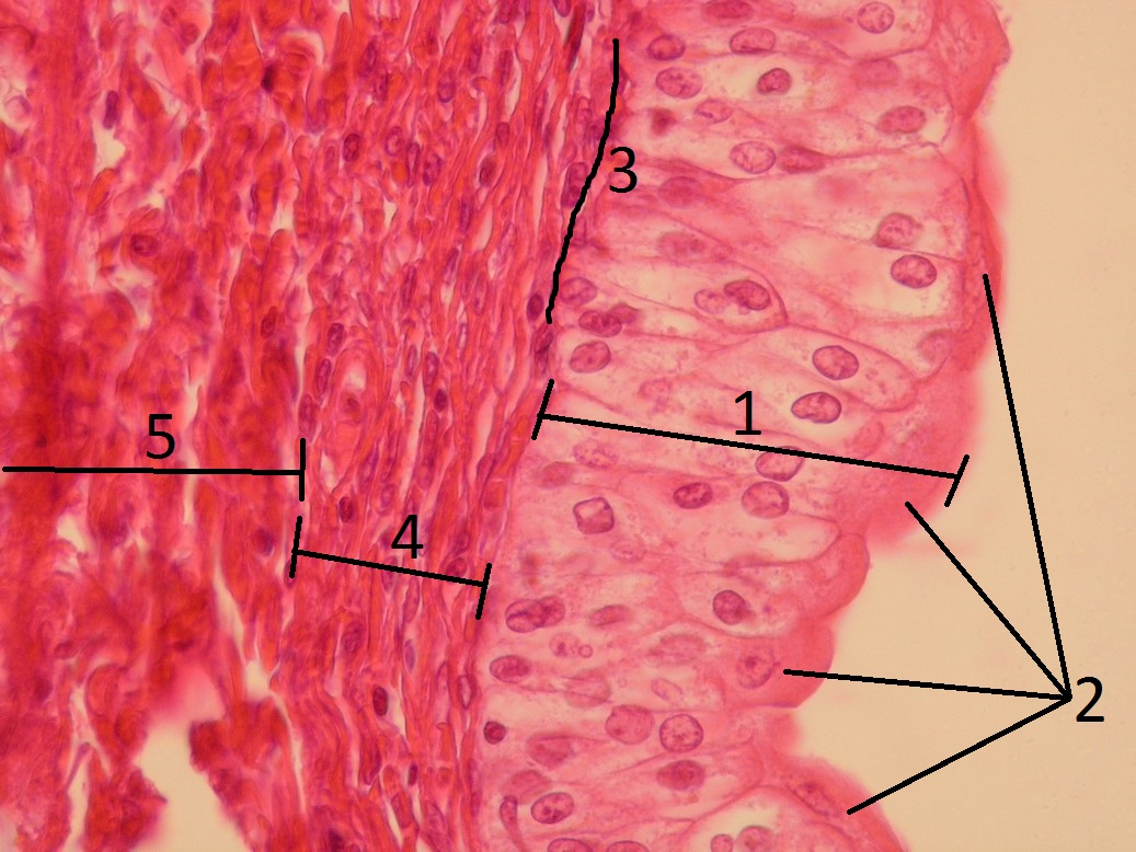 Vesica urinaria (SFLT) – WikiSkripta