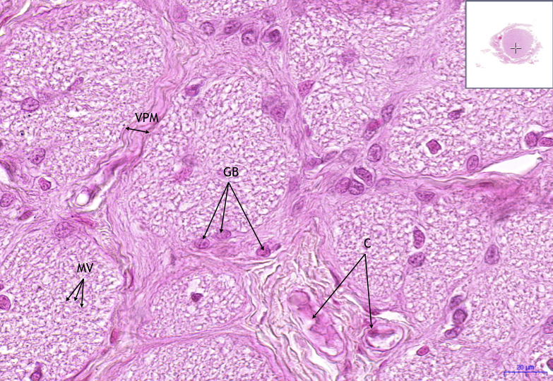 Nervus opticus - HE – WikiSkripta