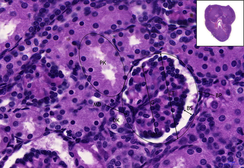 Ledvina / Kidney - HE – WikiSkripta