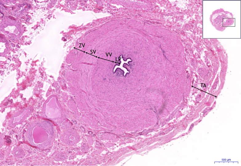 Funiculus spermaticus - HE – WikiSkripta