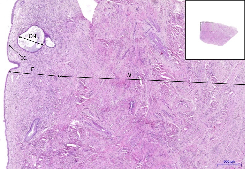 Uterus (endocervix) - HE – WikiSkripta