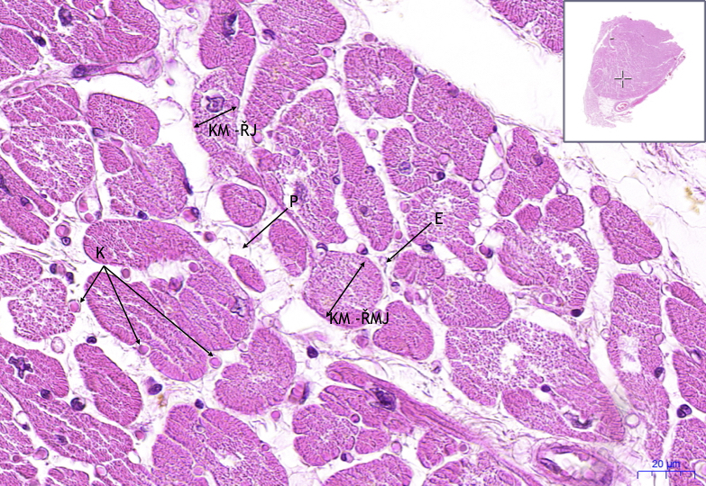 Srdeční sval / Cardiac muscle - HE – WikiSkripta