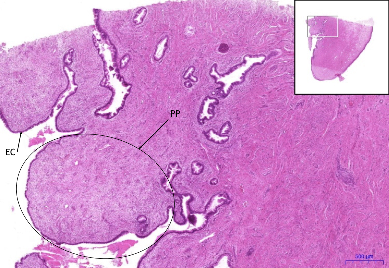 Uterus (exocervix) - HE – WikiSkripta